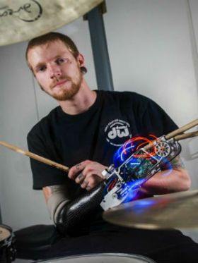 Conheça a inspiradora história de Jason Barnes, o baterista biônico ...